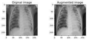 Chest X-ray Image 胸部 X 射线图像数据集 | Datasets | HyperAI超神经